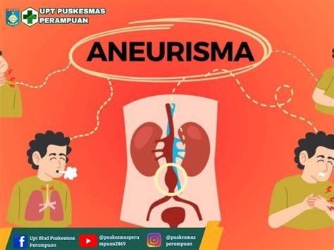 Puskesmas Perampuan Aneurisma