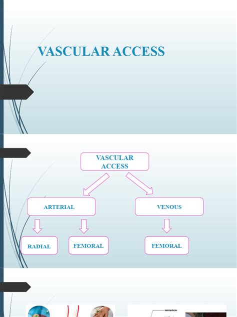Vascular Access In Cardiac Catheterization Pdf Wellness Science