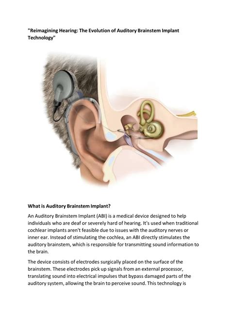 Ppt Auditory Brainstem Implant Market Powerpoint Presentation Free