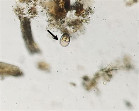 Coccidiosis In Chicken Pashudhan Praharee