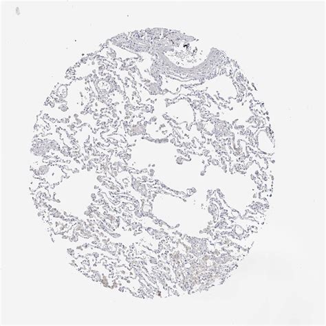 Tissue Expression Of Slc19a1 Staining In Lung The Human Protein Atlas