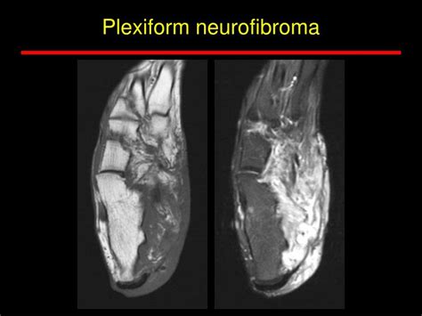 Ppt 1986 1987 Powerpoint Presentation Id959957