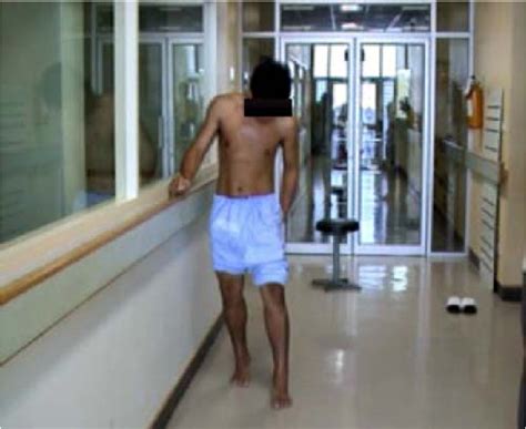 [pdf] Acquired Neuromyotonia Isaacs Syndrome A Case Report With