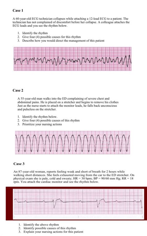 Ecg Cases Most Common Study Notes Nursing Docsity