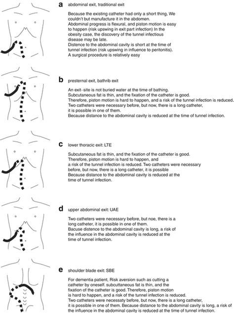 Peritoneal Access Abdominal Key