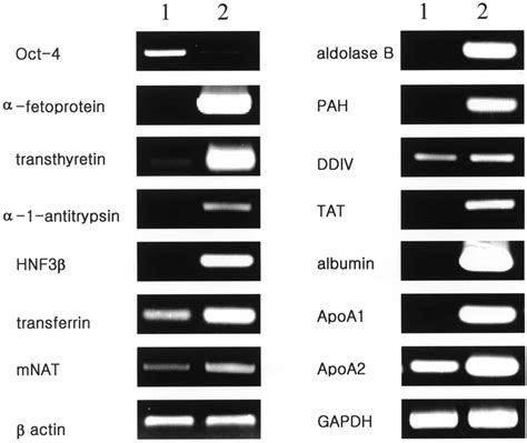 mrna expression analysis of es cell derived teratoma lane 1