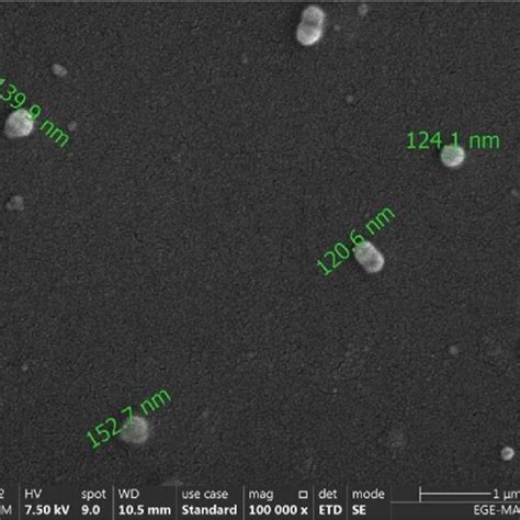 Sem Image Of Niosome Formulation A Philips Xl 30s Feg Brand Scanning